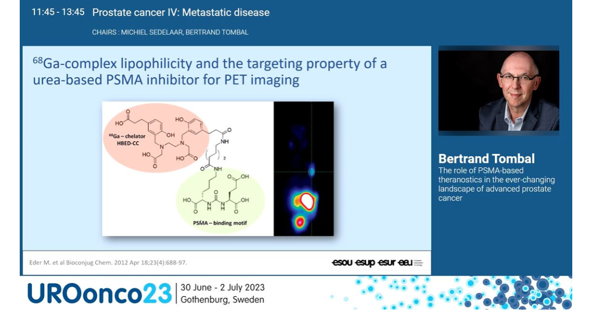 The role of PSMA-based theranostics in the ever-changing landscape of advanced prostate cancer ...